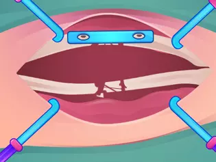 Funny Bone Surgery . Online Games . BrightestGames.com